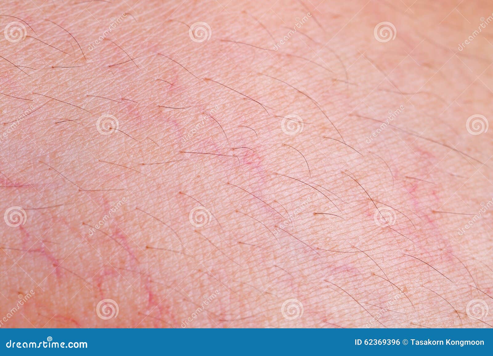 Skin Texture With Capillary For Pattern Stock Photography ...