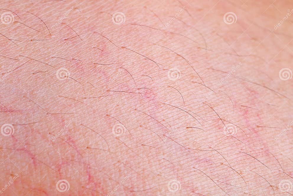 Skin Texture with Capillary for Pattern Stock Photo - Image of clean ...