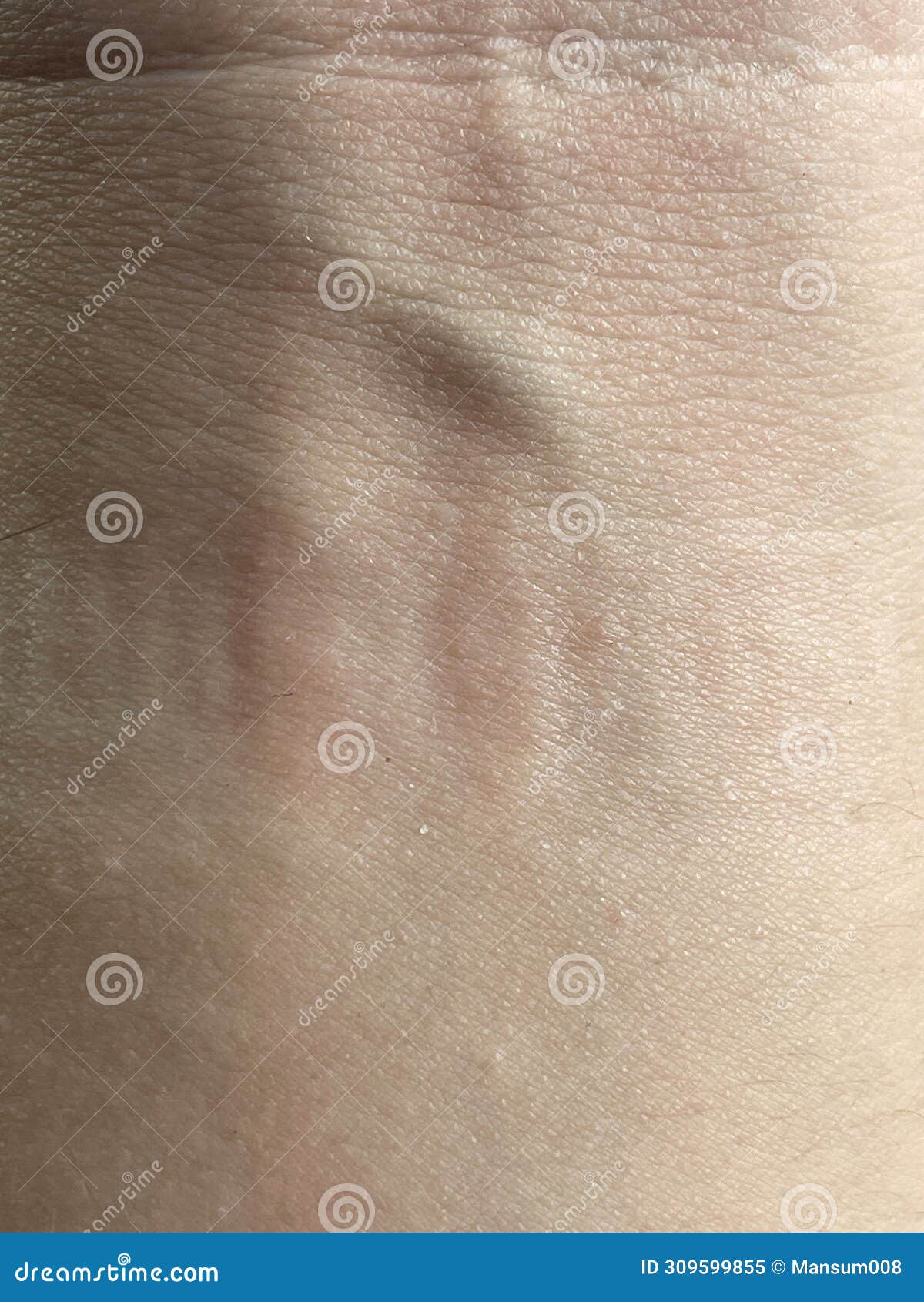 Skin Texture, Close Up of Human Skin Stock Image - Image of medical ...