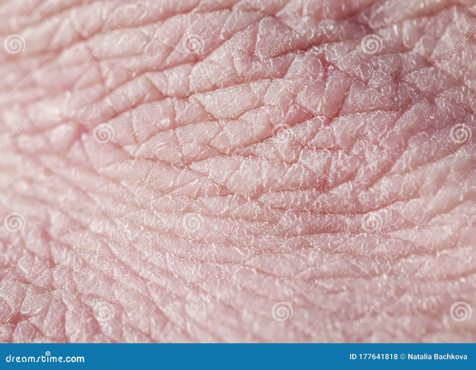 Human Skin Texture Covered with Deep Wrinkles and Dry Scales Stock ...