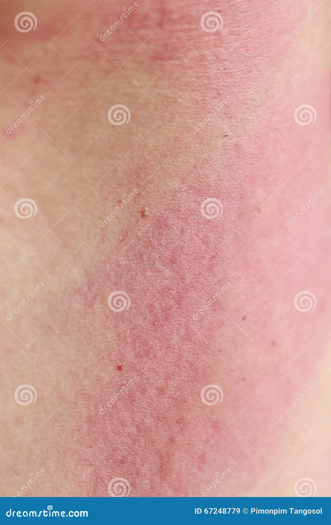 Skin texture stock image. Image of body, health, girl - 67248779