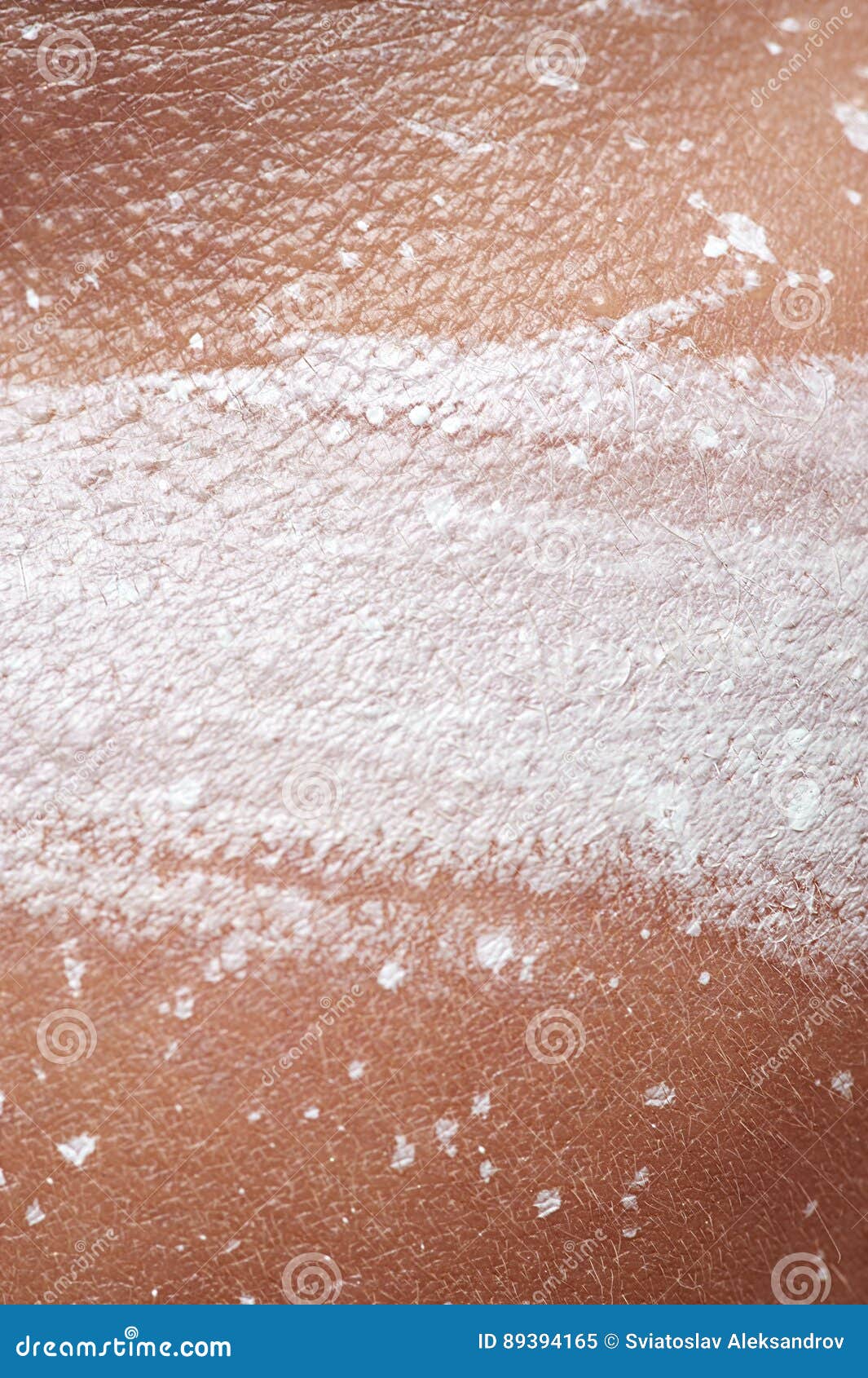 Skin Texture with Splashes of White Paint Stock Image - Image of ...