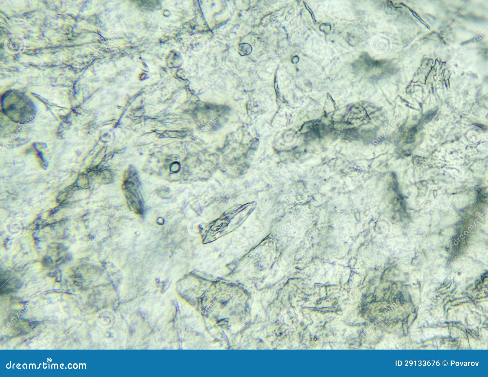 Skin under the microscope stock photo. Image of detail - 29133676