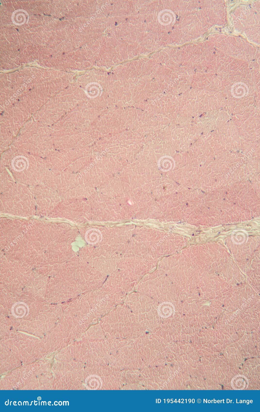 Skin under the microscope stock photo. Image of skin - 195442190