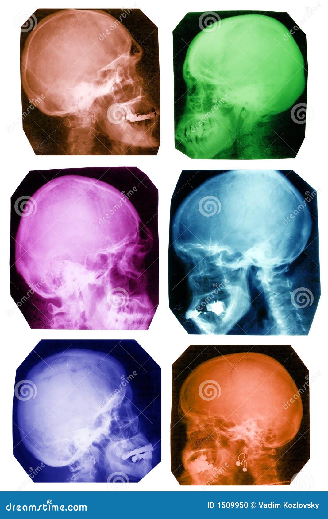 Skull Collection in Colours Stock Photo - Image of ligament, clinic ...