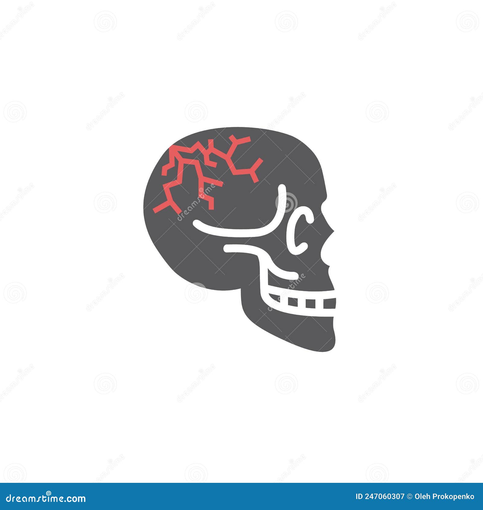 Skull, Cracked Skull Icon ,black Sign Design. Vector Illustration for ...