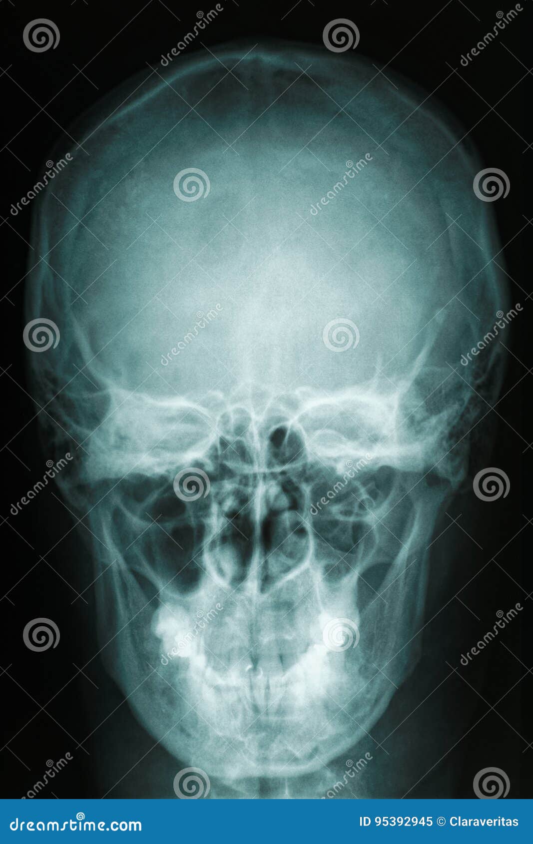Skull head radiology scan stock image. Image of axon - 95392945