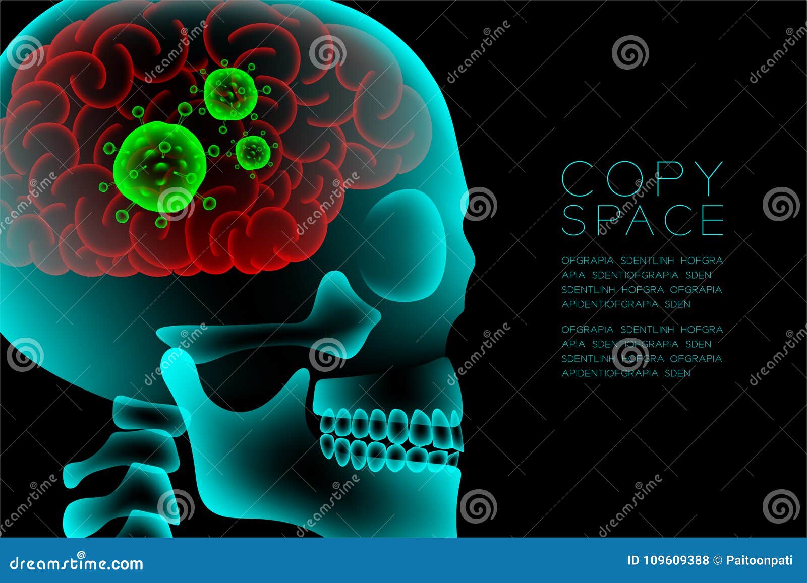 Skull X-ray with Microscope Disease Cells in Brain Concept Design Stock ...
