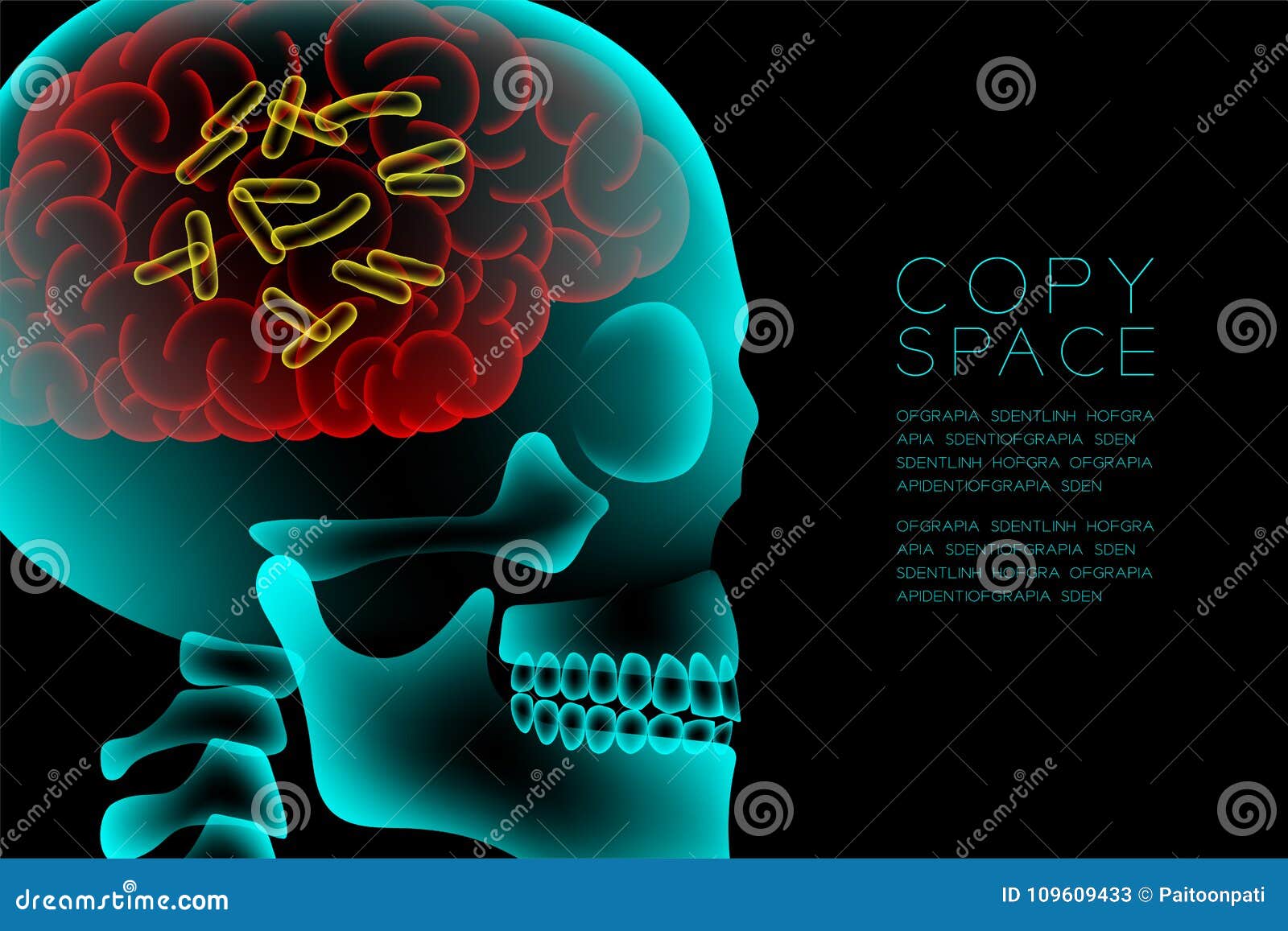 Skull X-ray with Microscope Disease Cells in Brain Concept Design Stock ...