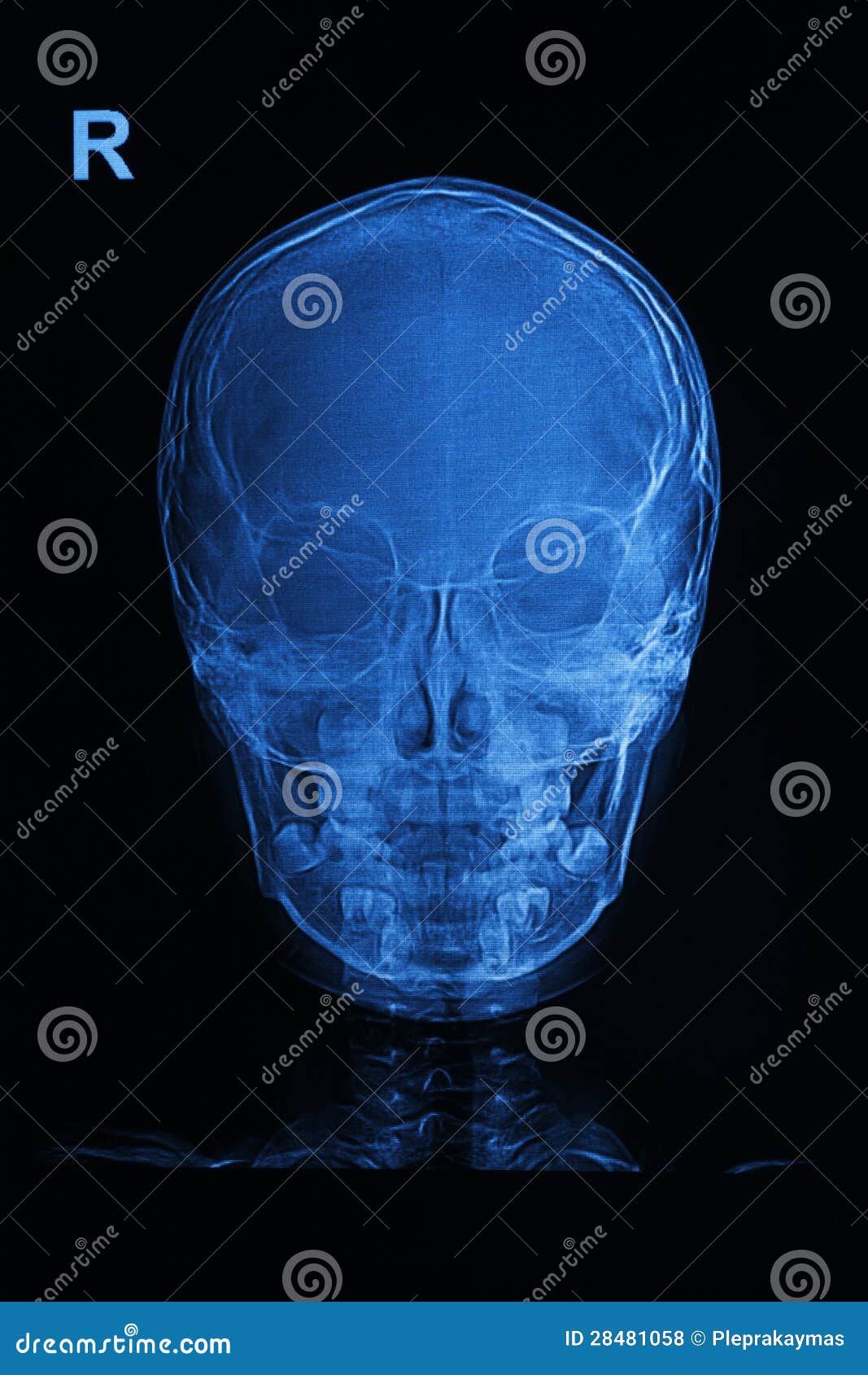 Skull x-rays image stock photo. Image of front, segment - 28481058