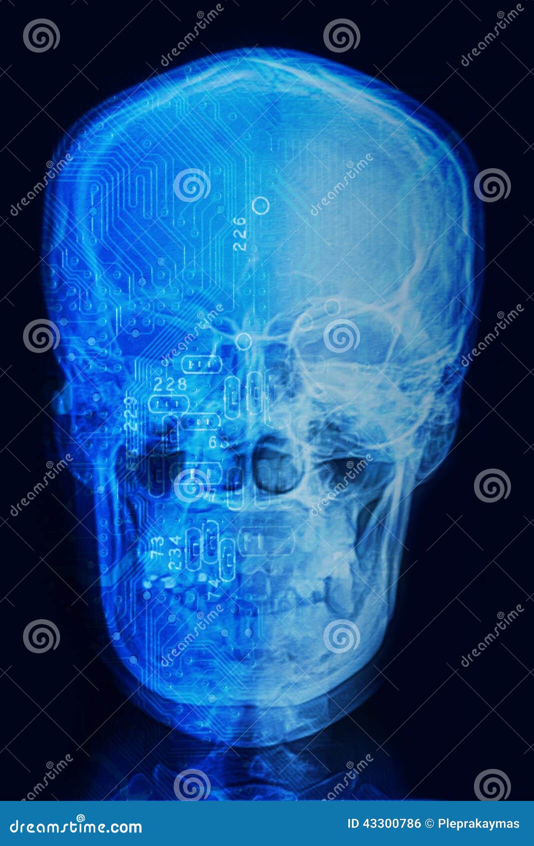 Skull X-rays Image with Computer Chip and Circuit Stock Photo - Image ...