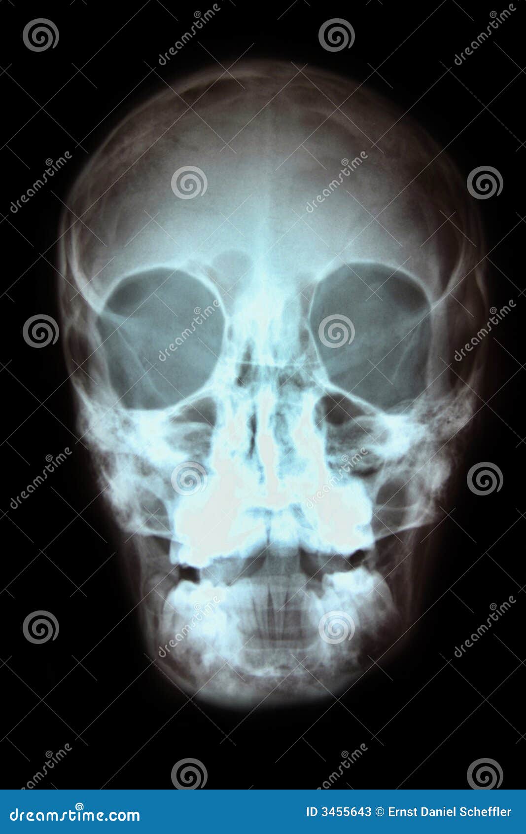 Skull X-ray Stock Photos - Image: 3455643