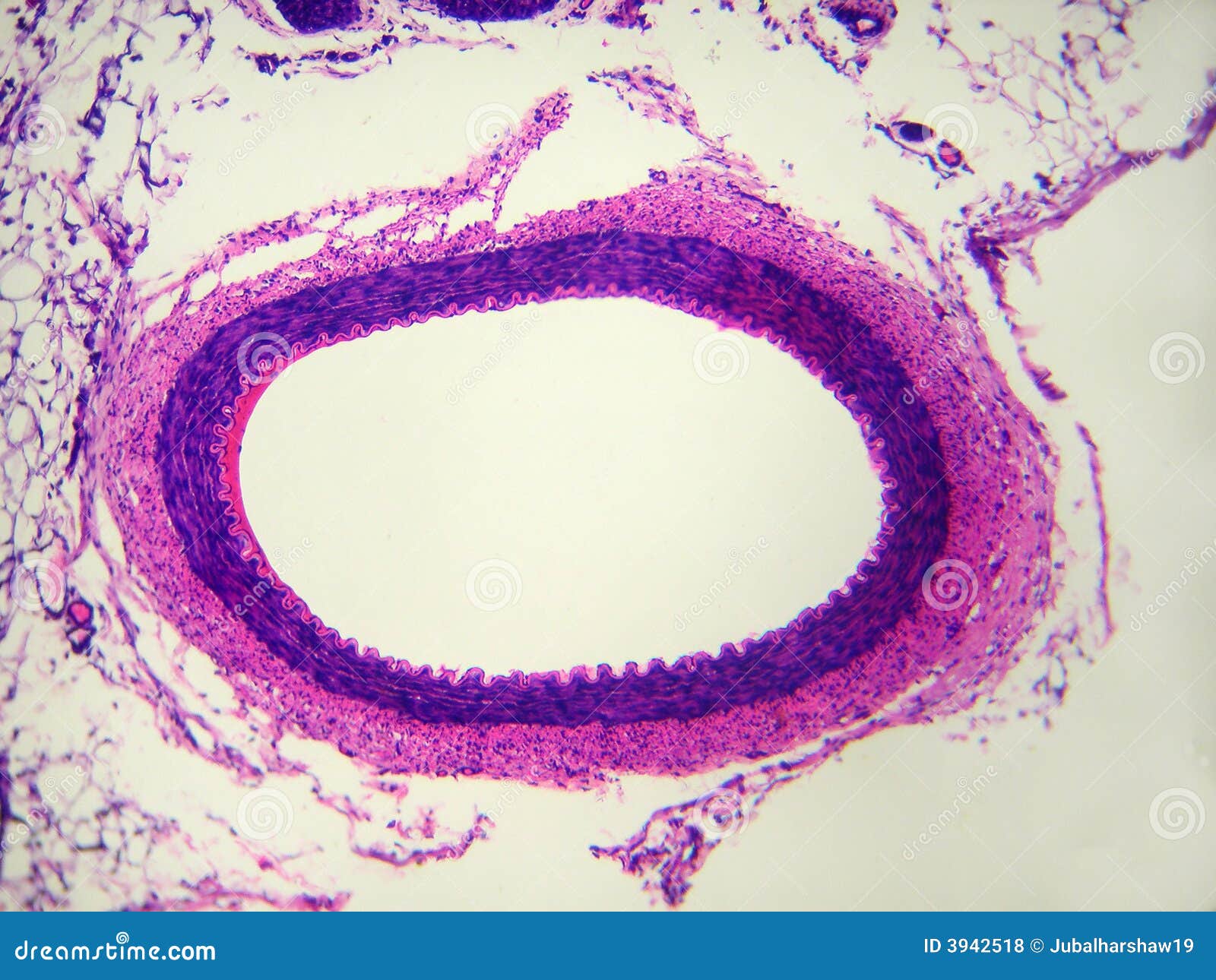 Slagader PK N4826 stock foto. Image of ziekte, anatomie - 3942518