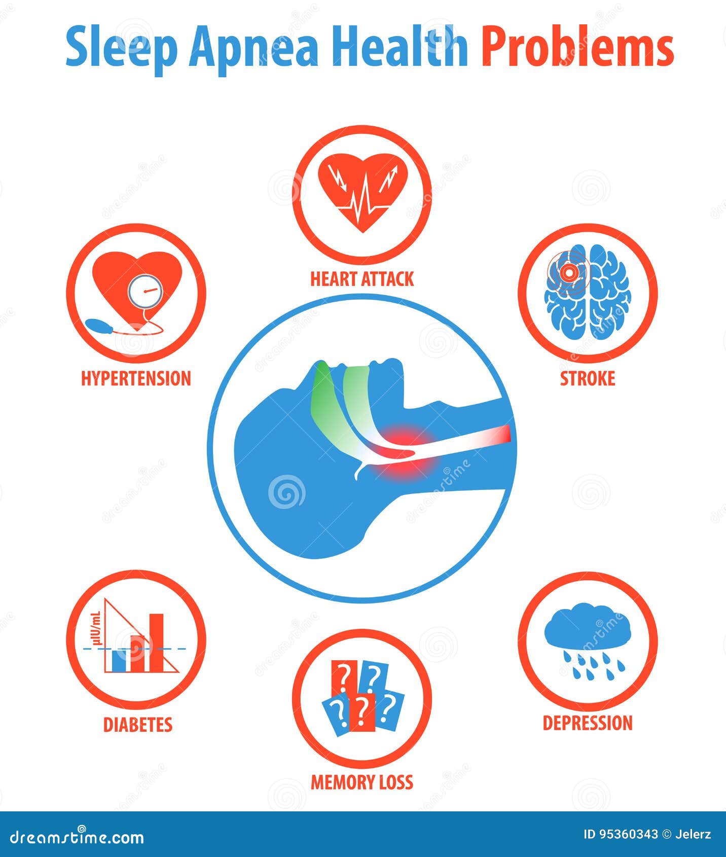Sleep Apnea Treatments Causes Symptoms And Health Problems Stock