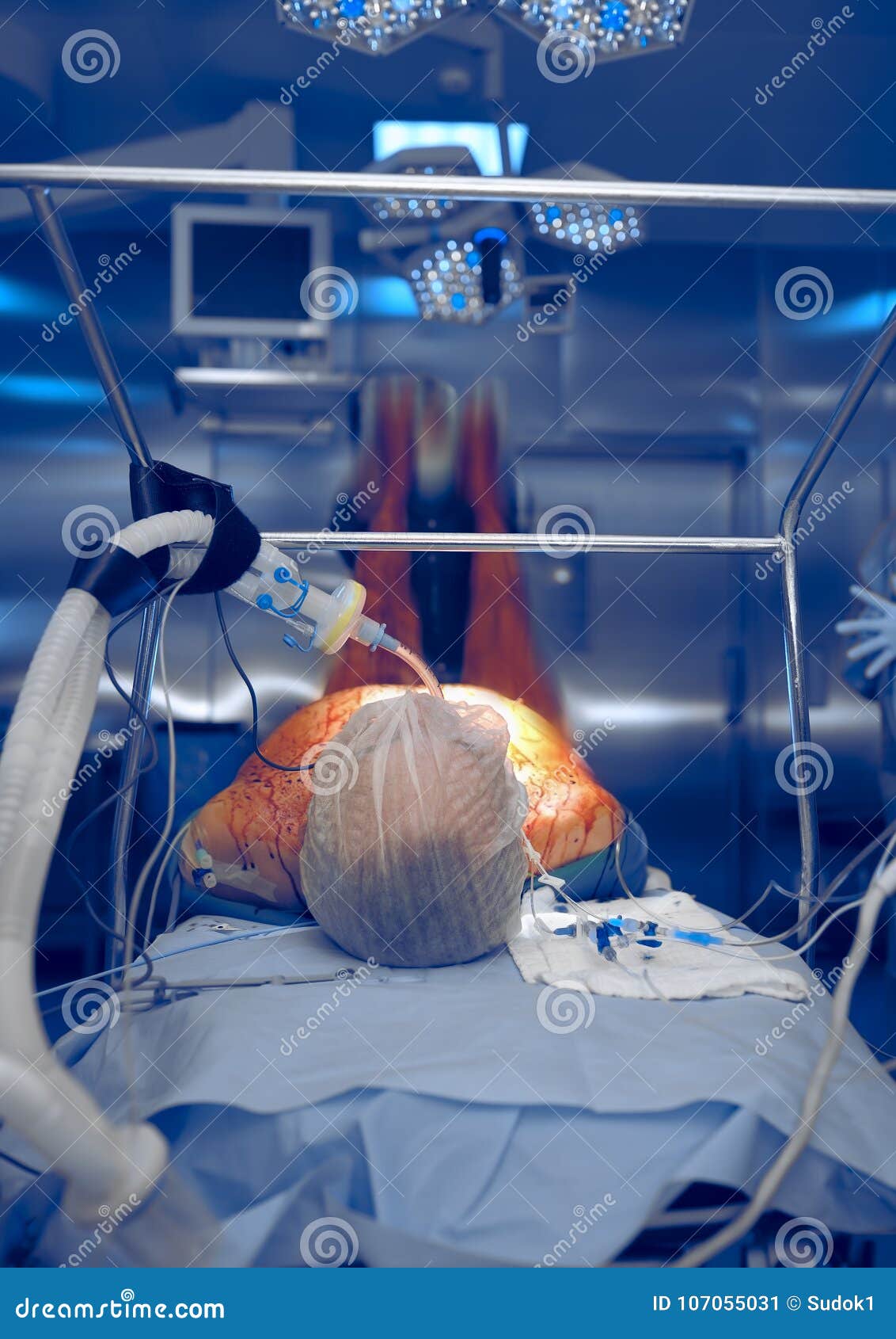 Sleeping Patient on the Operating Table Prepared To the Surgery Stock ...