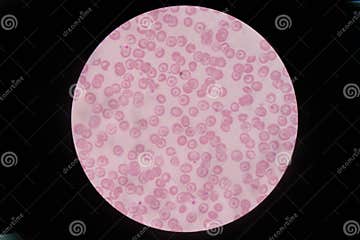 Slide blood smear stock photo. Image of tube, test, sample - 80361036