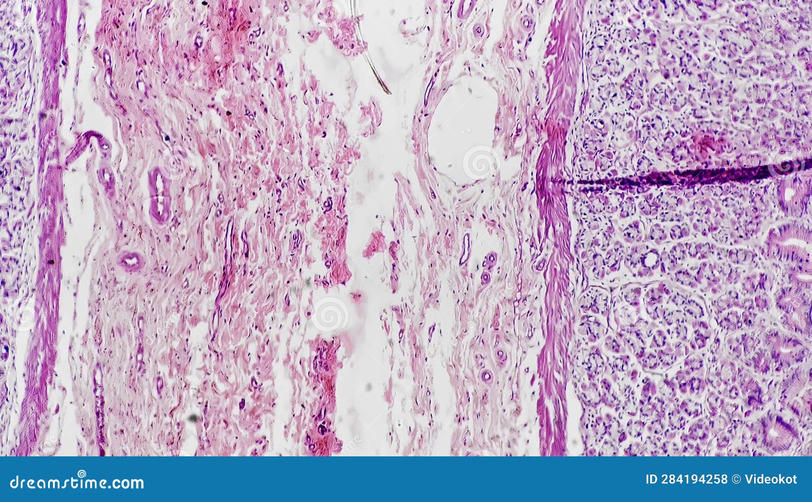 Slide with Pattern of Human Stomach in Section Studied in Lab Under ...