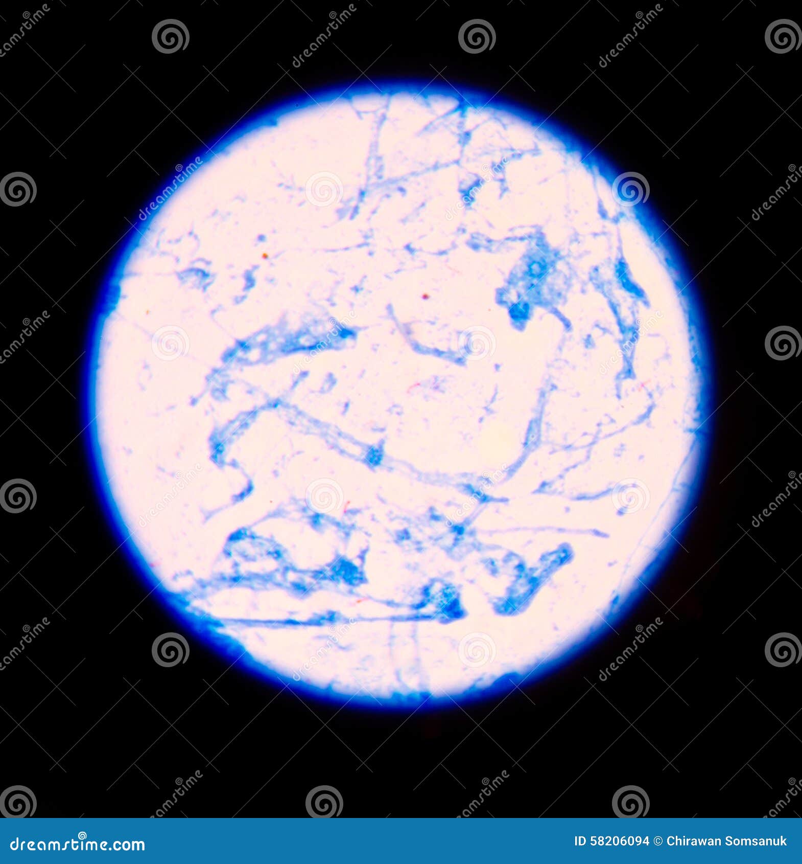 Slide sputum AFB. stock photo. Image of biology, organism - 58206094