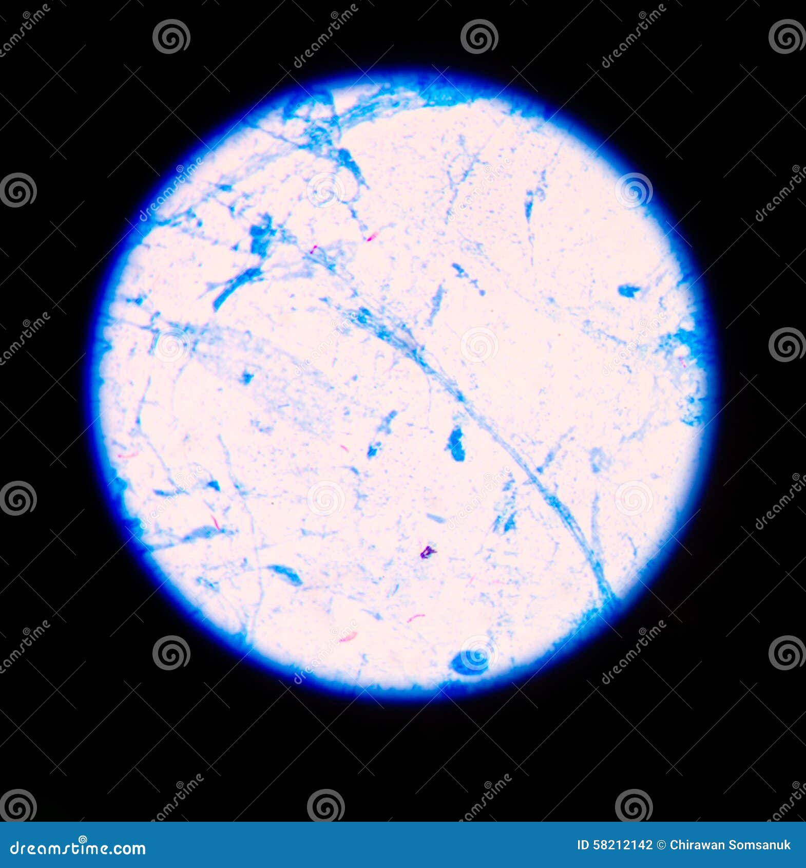 Slide sputum AFB. stock photo. Image of care, epidemic - 58212142