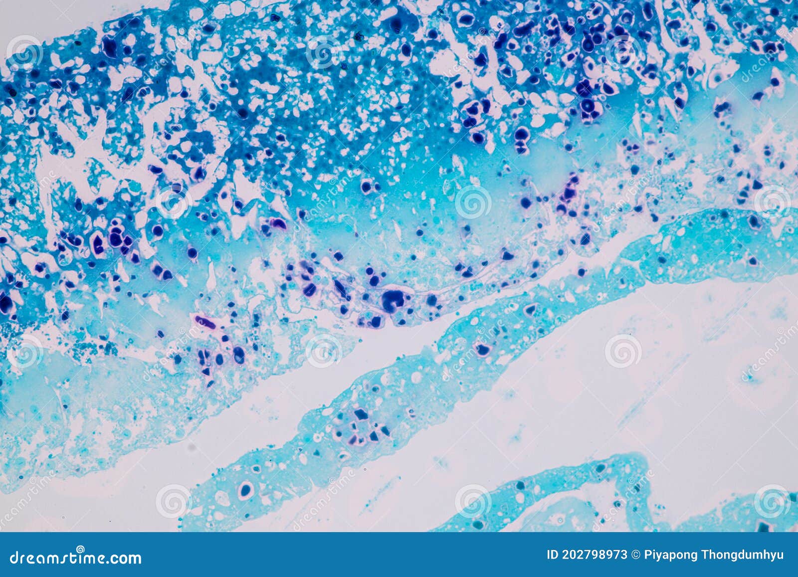 Slime Molds, As a Group, are Polyphyletic. Stock Image - Image of ...