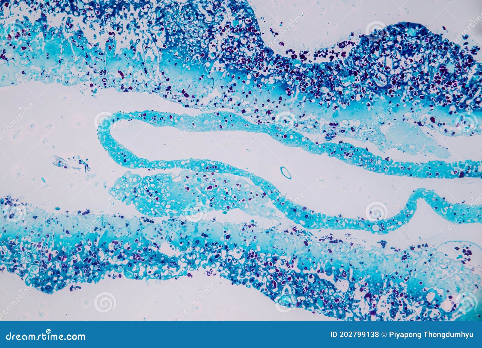 Slime Molds, As a Group, are Polyphyletic. Stock Photo - Image of ...