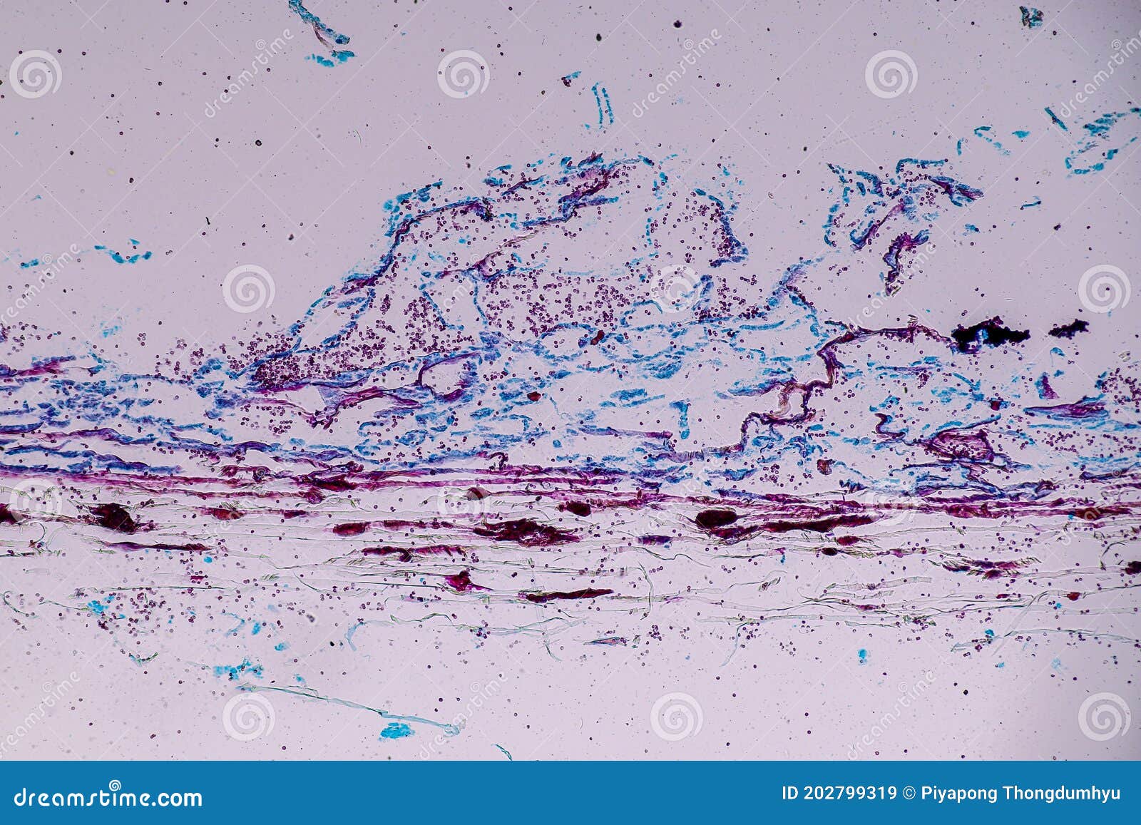 Slime Molds, As a Group, are Polyphyletic. Stock Image - Image of close ...