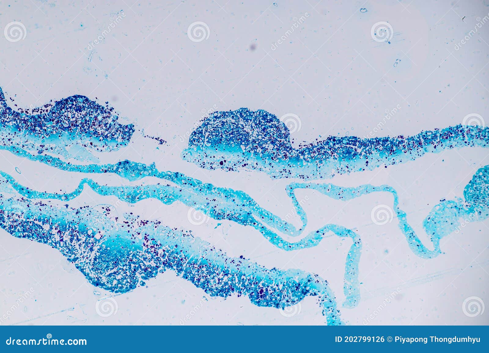 Slime Molds, As a Group, are Polyphyletic. Stock Photo - Image of ...