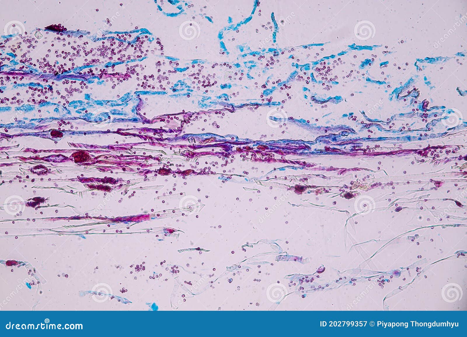 Slime Molds, As a Group, are Polyphyletic. Stock Image - Image of ...