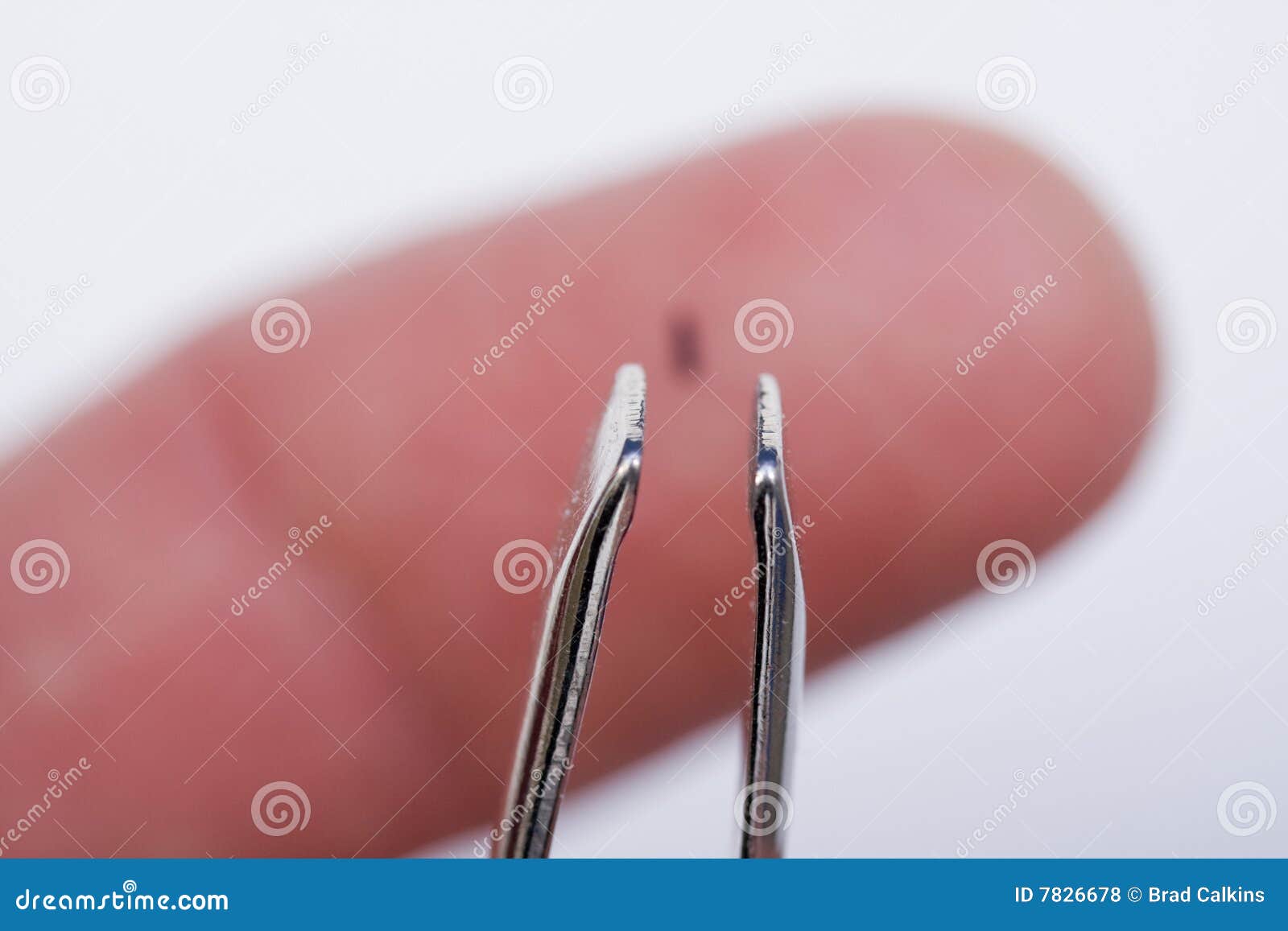 Sliver stock photo. Image of pain, sliver, metal, hand - 7826678