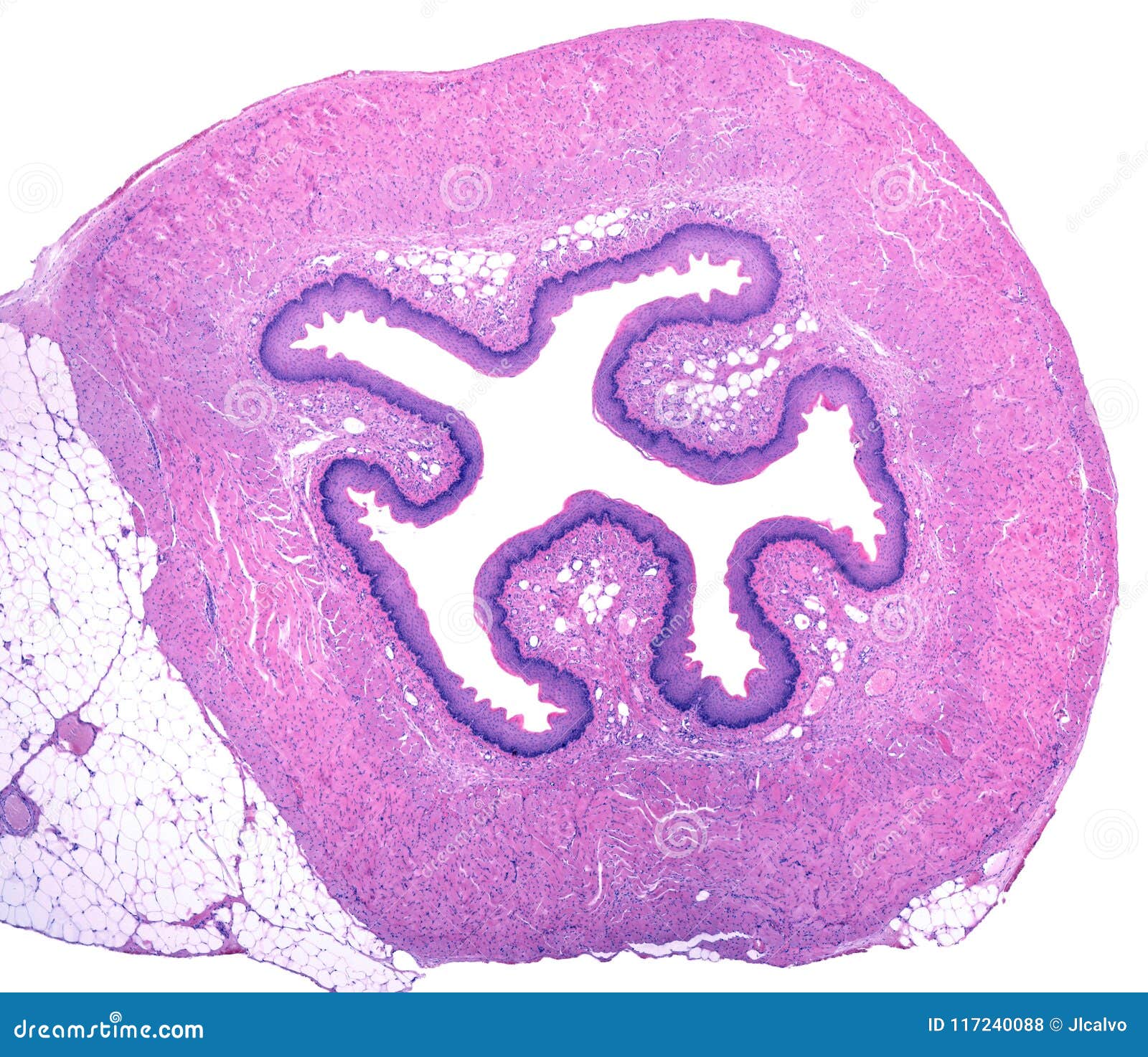 Slokdarm Gelaagde Scamous Epipthelium Stock Foto - Image of microscopie ...