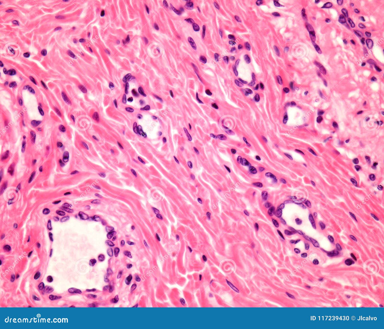 Slokdarmsubmucosa Bindweefsel Stock Foto - Image of microscoop ...