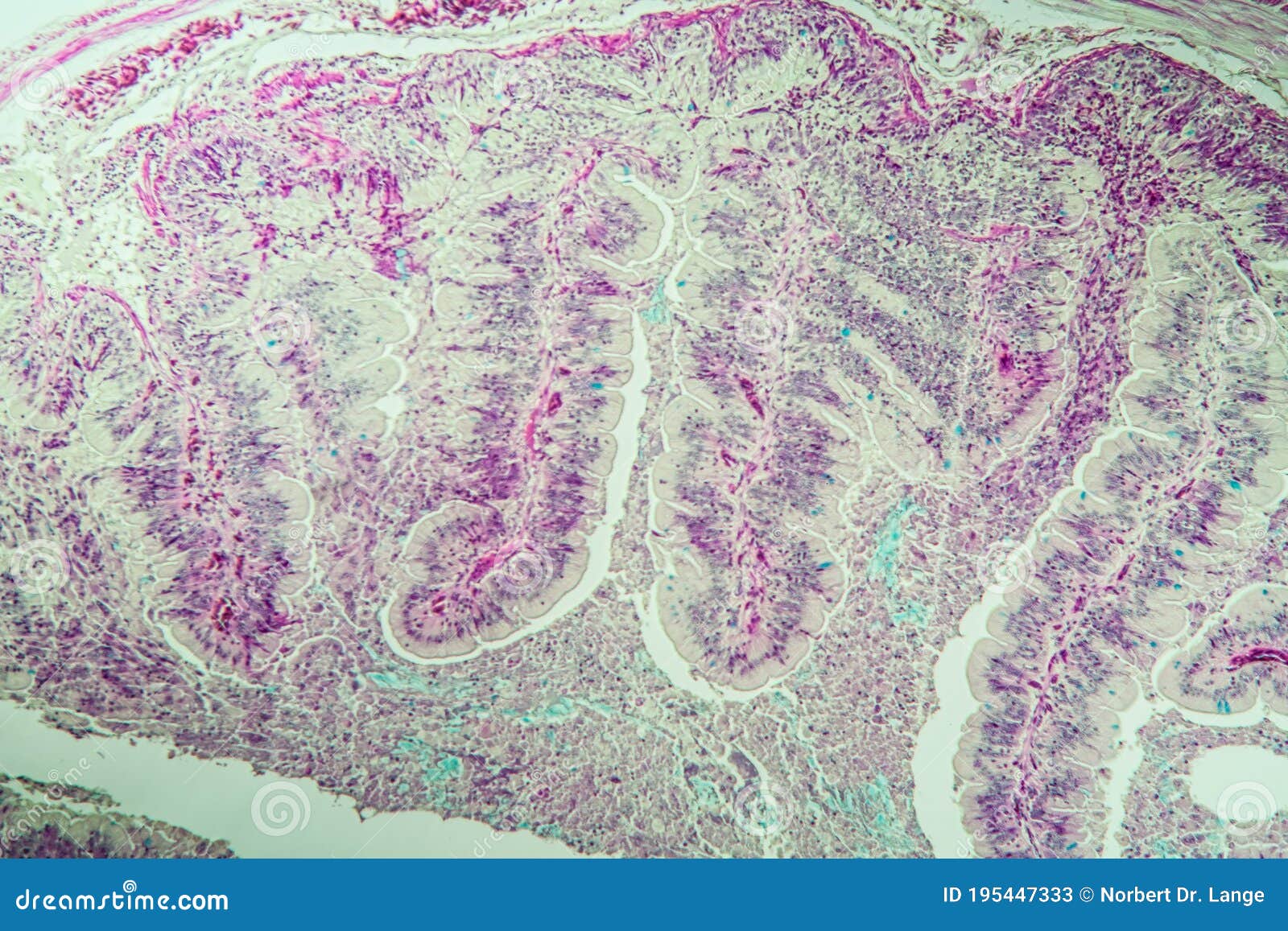 Slow Worm Histology Bowel Transverse Stock Image - Image of sneak ...
