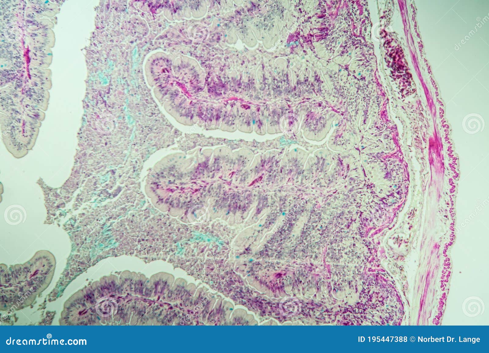 Slow Worm Histology Bowel Transverse Stock Photo - Image of intestine ...