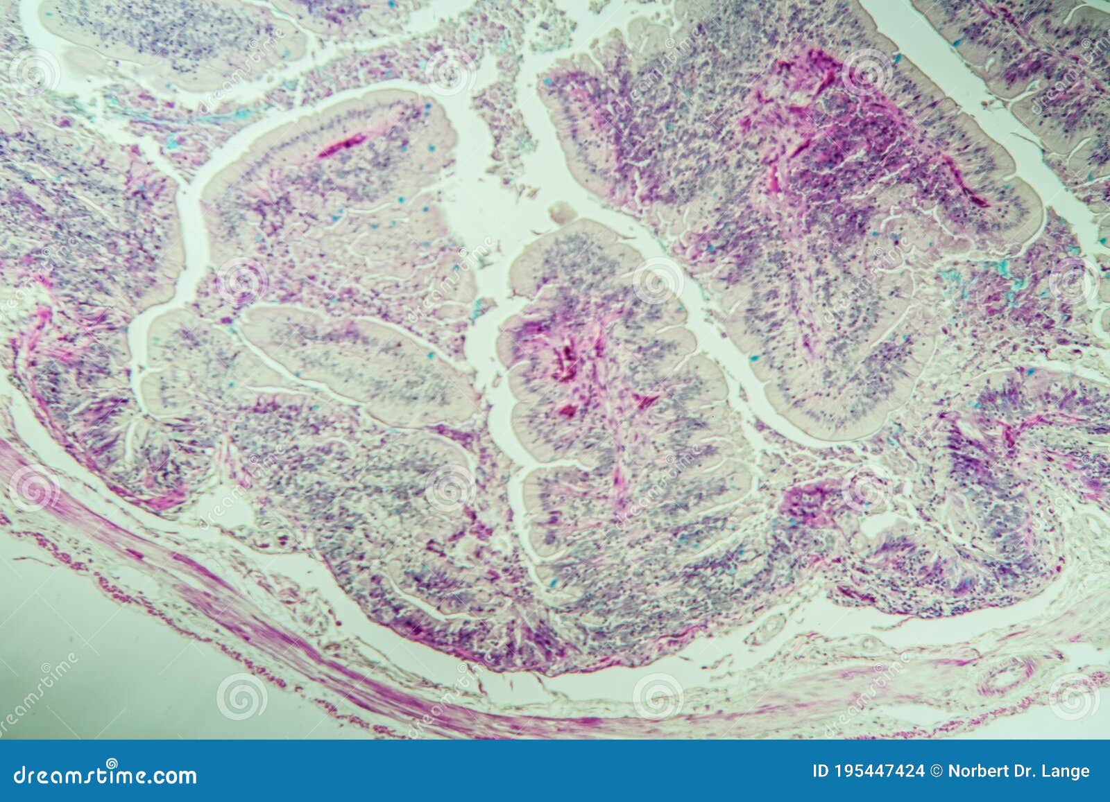 Slow Worm Histology Bowel Transverse Stock Photo - Image of schleiche ...