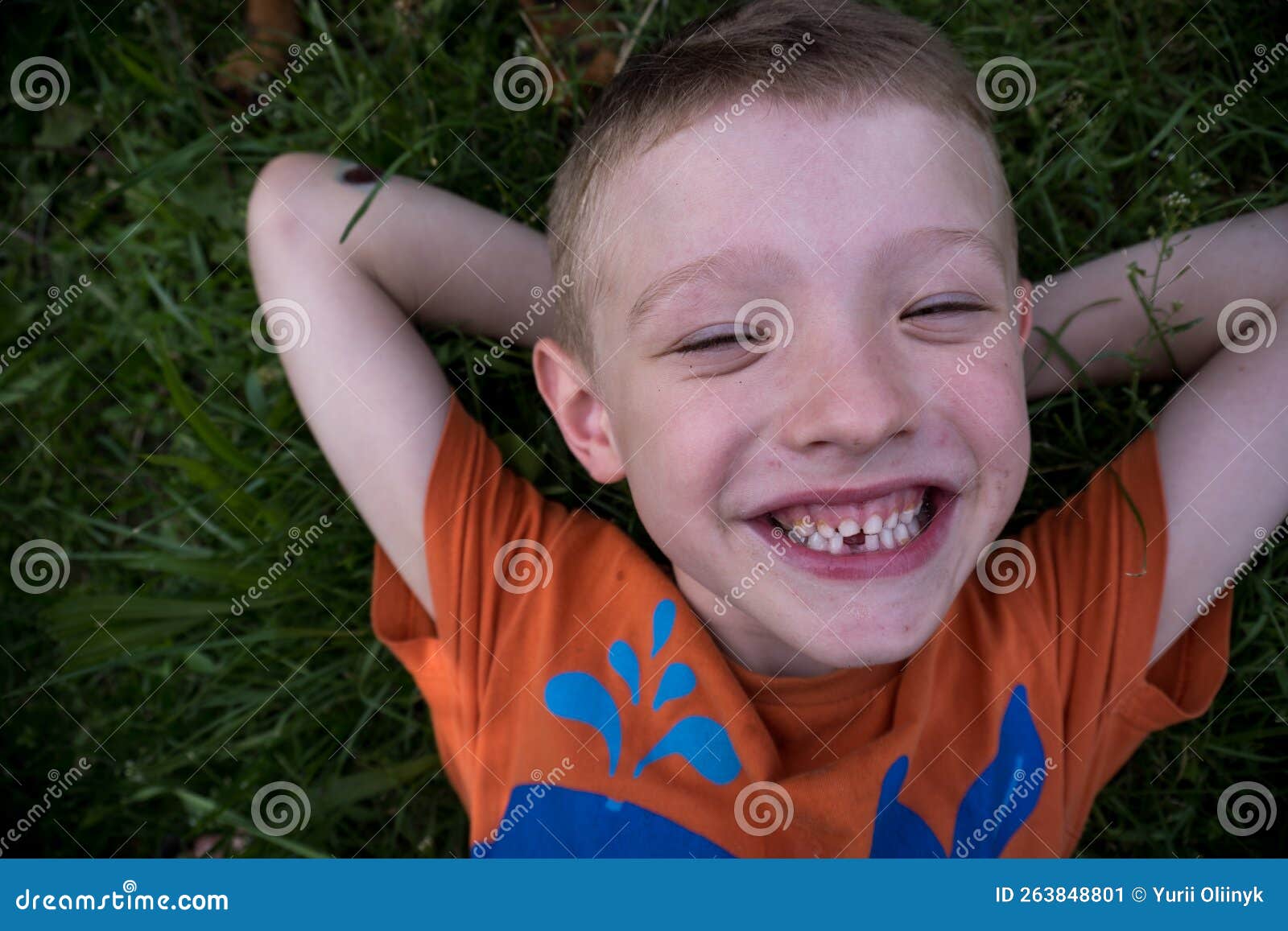 Small Child Lost the First Tooth Stock Image - Image of blue, active ...