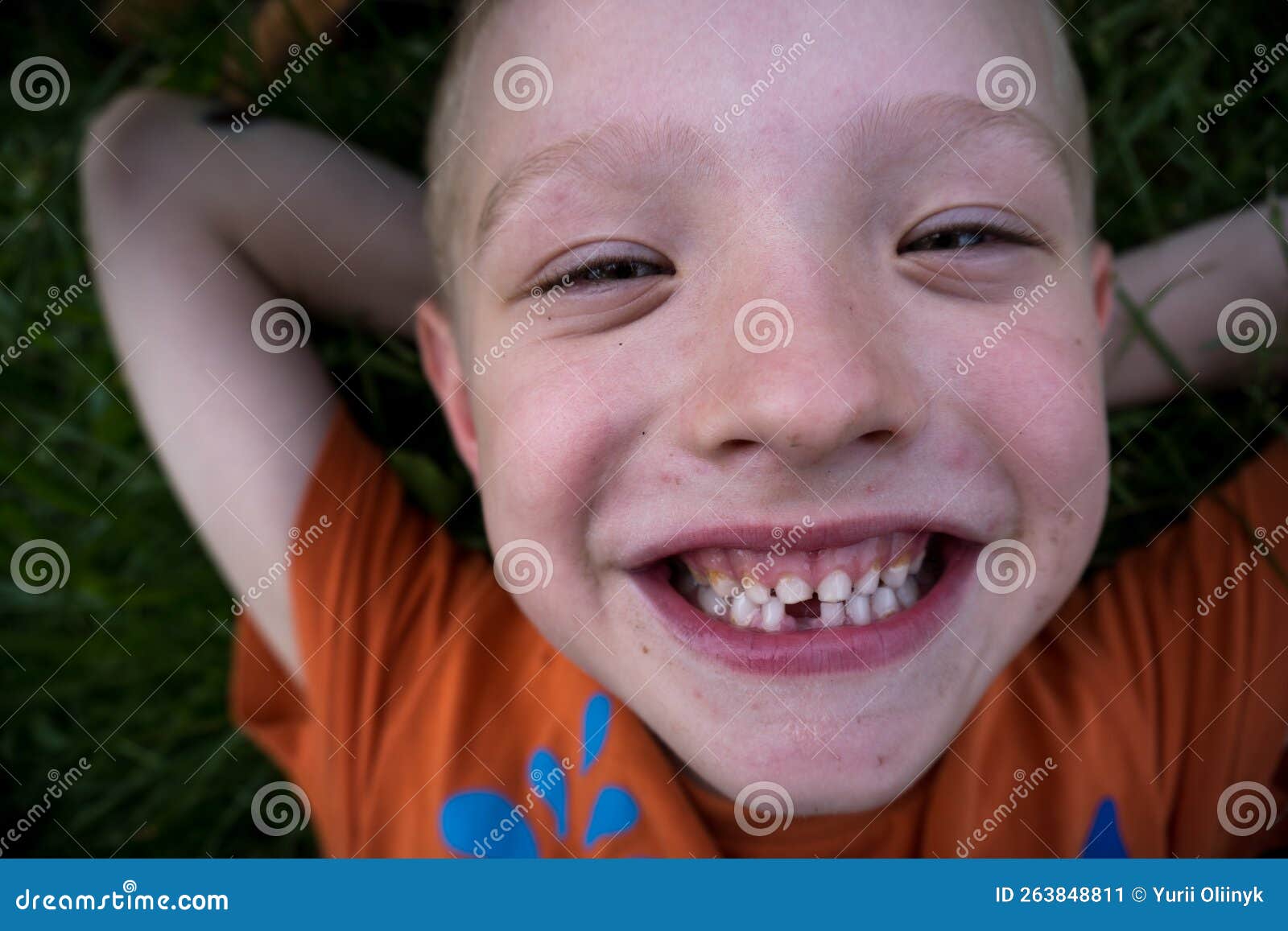 Small Child Lost the First Tooth Stock Image - Image of health, floor ...