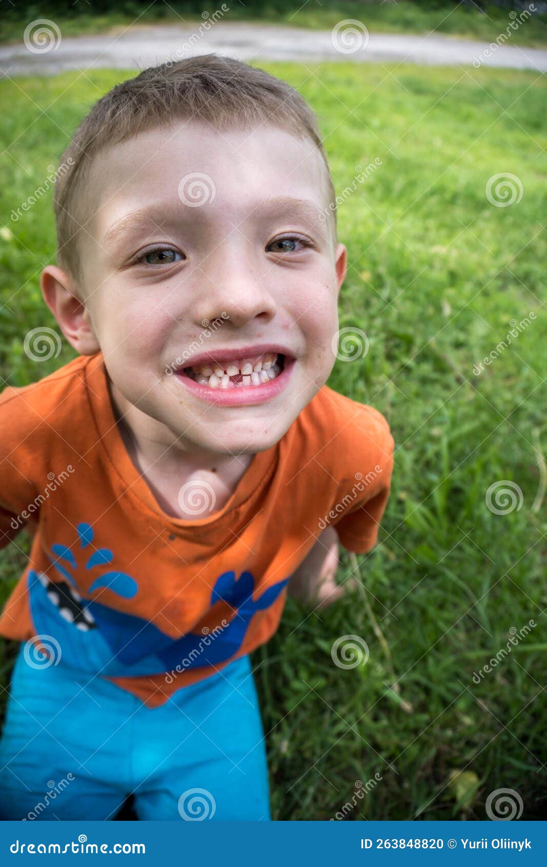 Small Child Lost the First Tooth Stock Photo - Image of combat, hobby ...