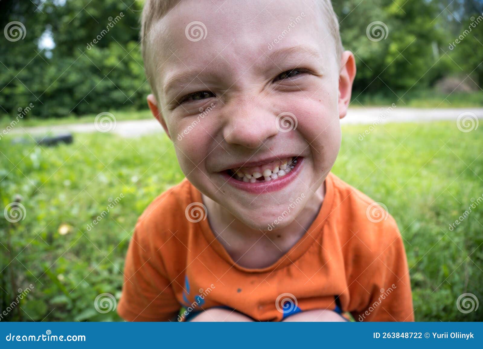 Small Child Lost the First Tooth Stock Photo - Image of autumn, hobby ...