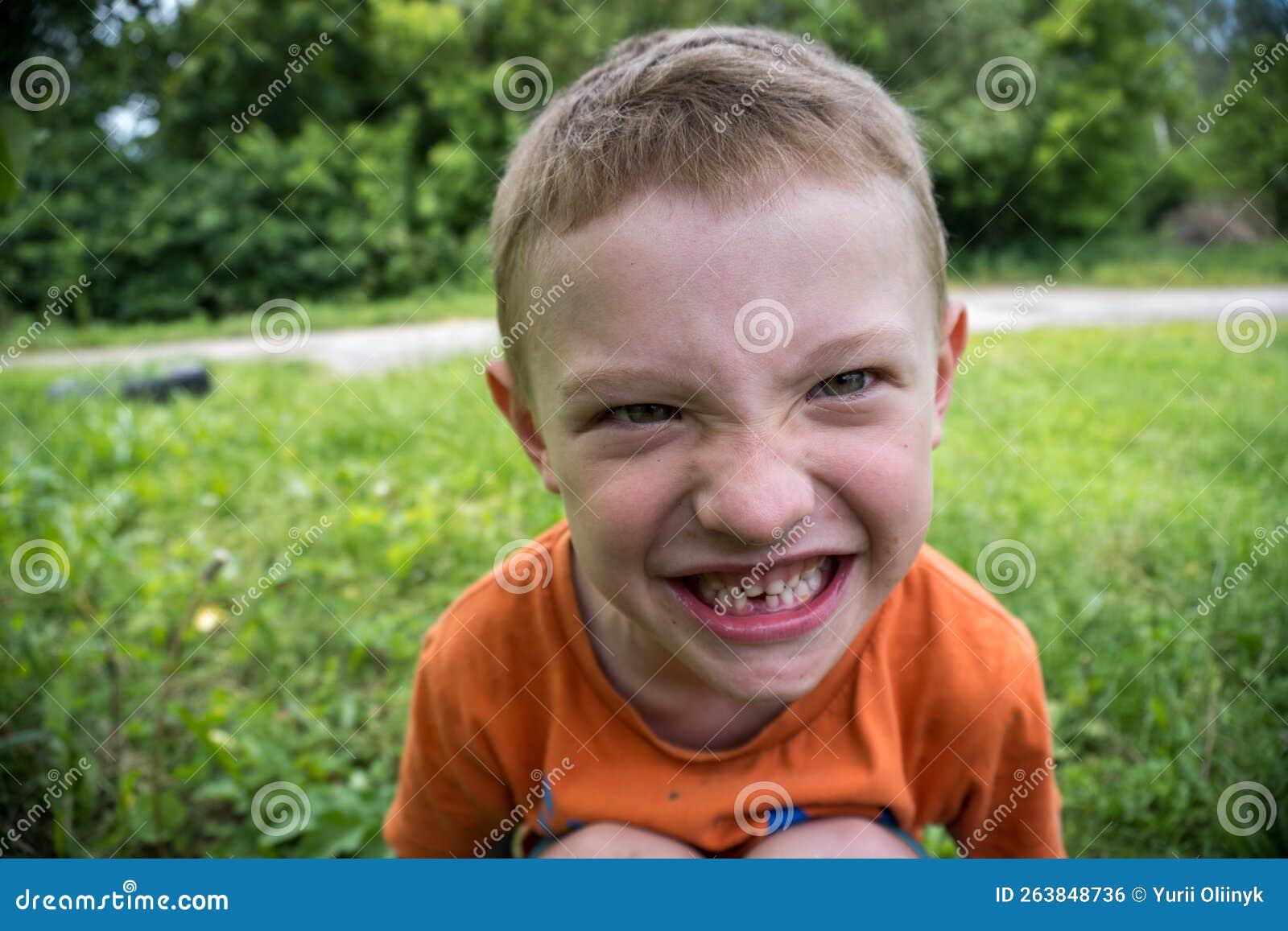 Small Child Lost the First Tooth Stock Photo - Image of exercise ...