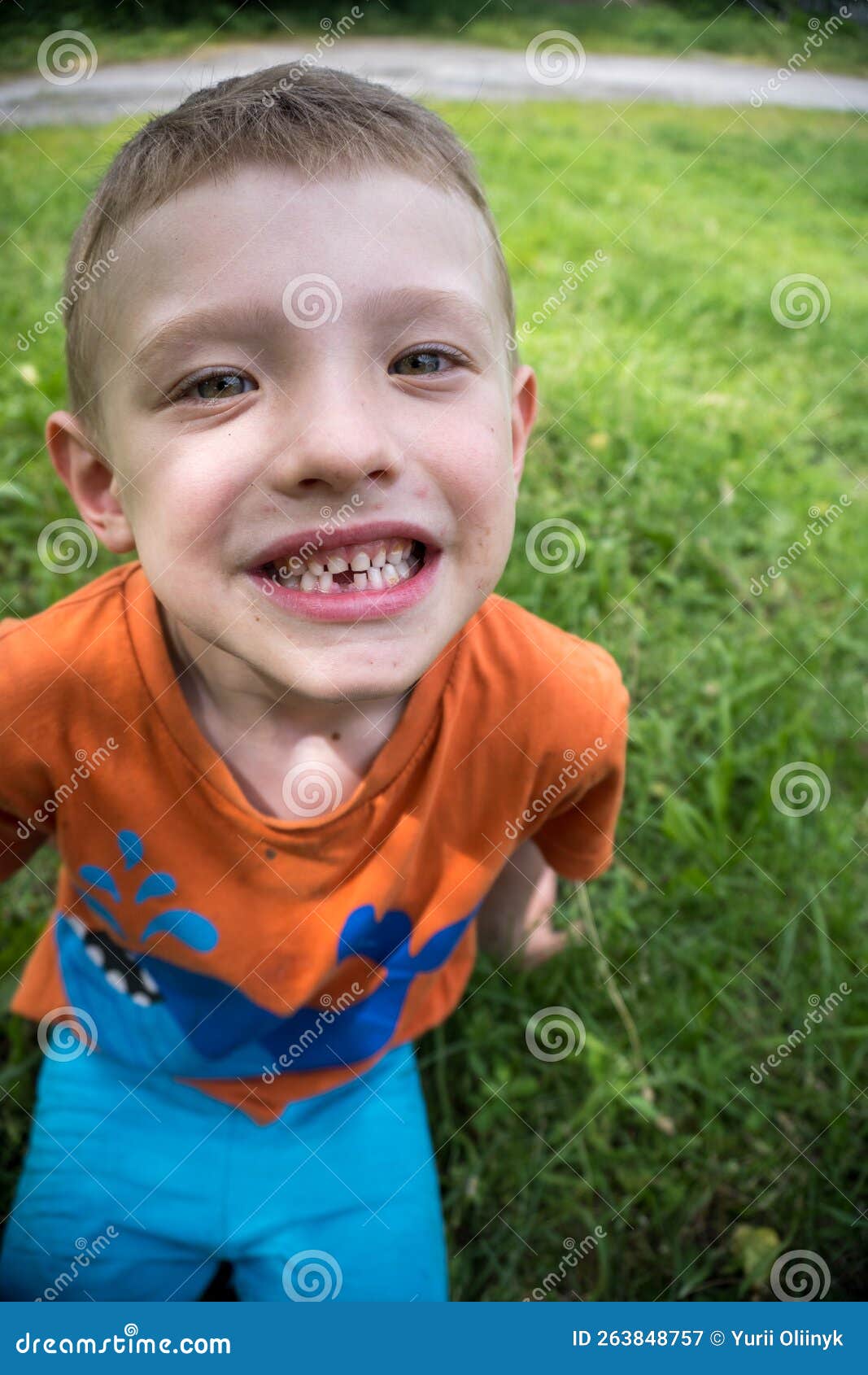 Small Child Lost the First Tooth Stock Image - Image of athlete ...