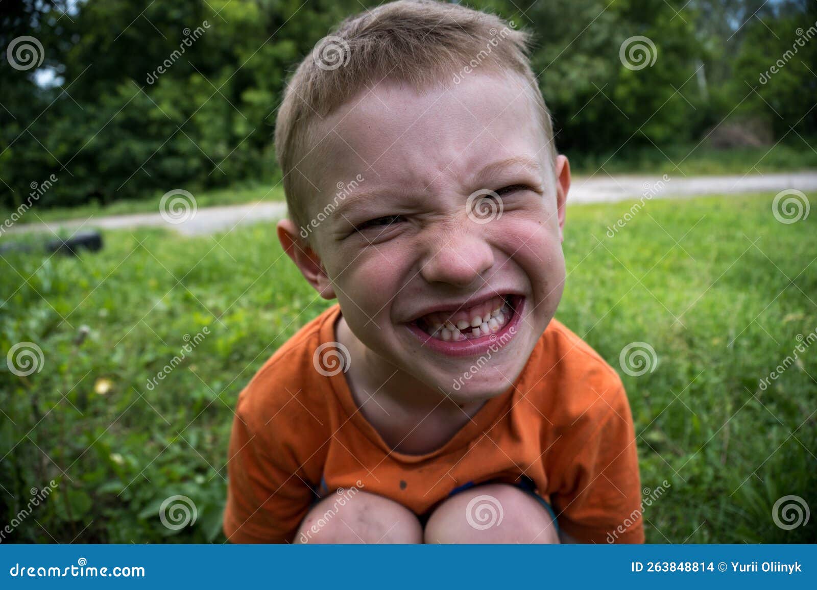 Small Child Lost the First Tooth Stock Photo - Image of hand, hobby ...