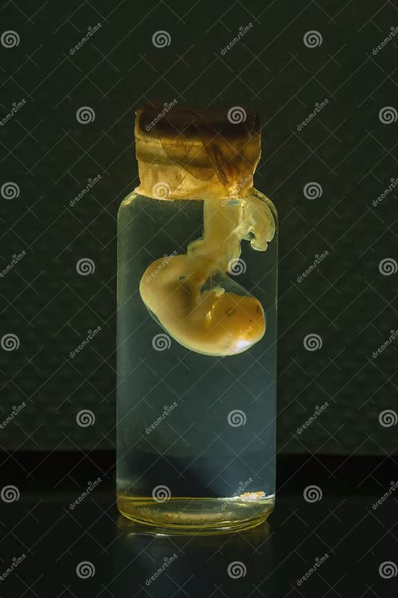 Small Fetus in a Jar with Formalin Stock Photo - Image of ...