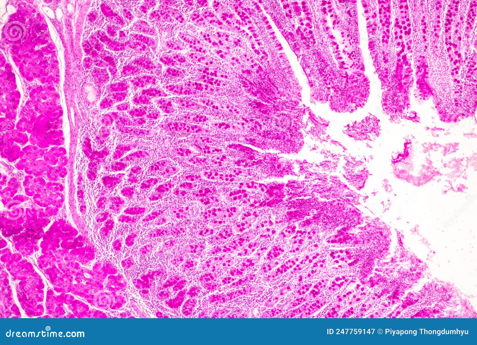 Small Intestine Duodenum and Vermiform Appendix Human Under the ...