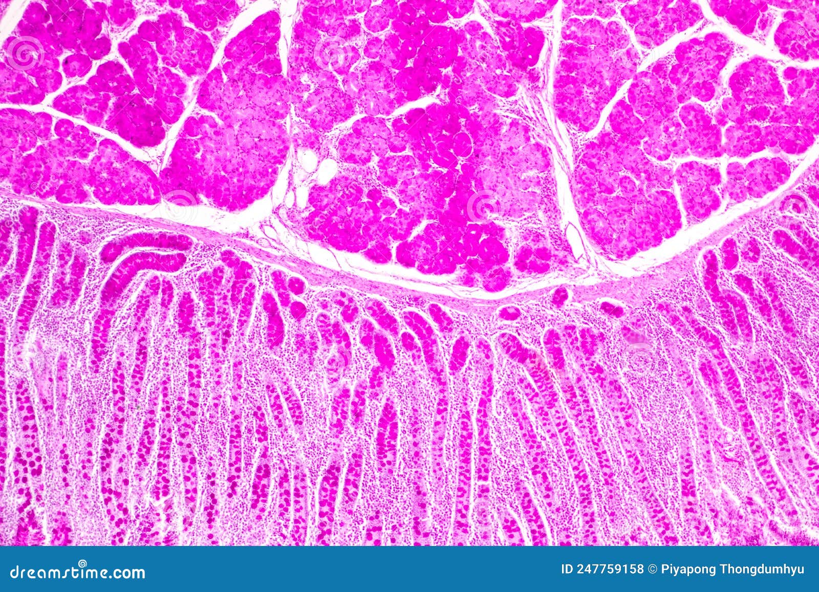 Small Intestine Duodenum and Vermiform Appendix Human Under the ...