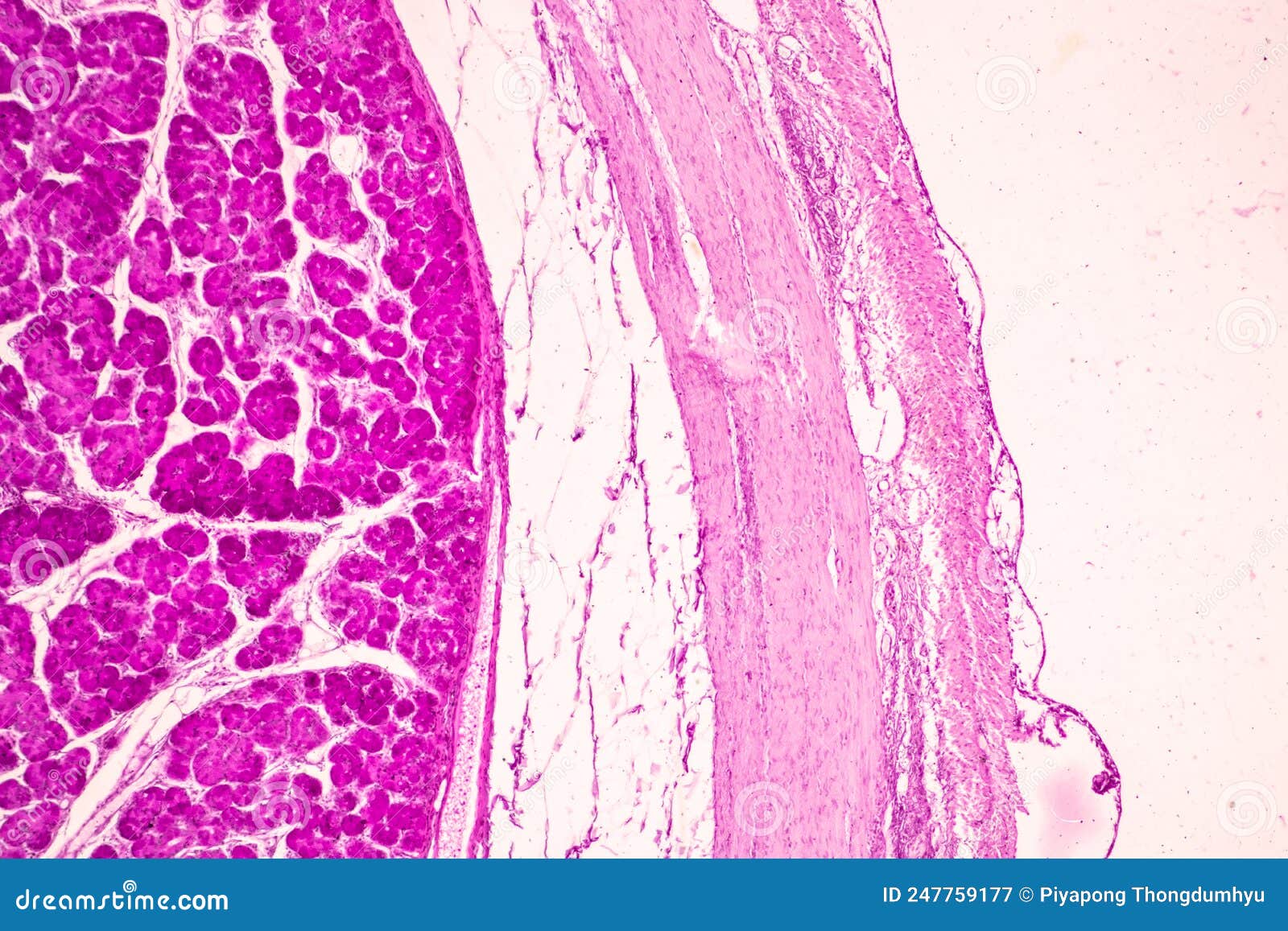 Vermiform Appendix Histology