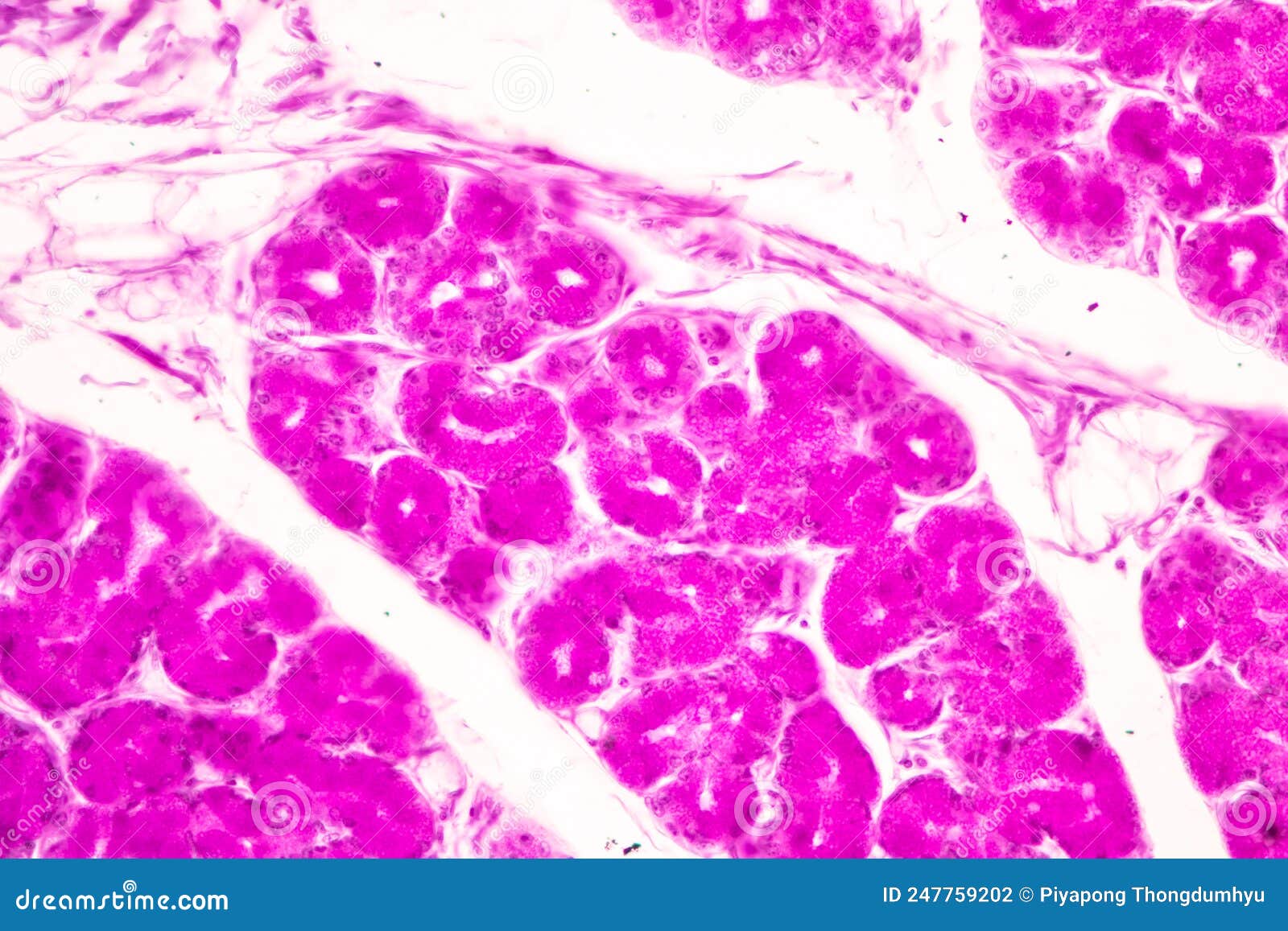 Small Intestine Duodenum and Vermiform Appendix Human Under the ...