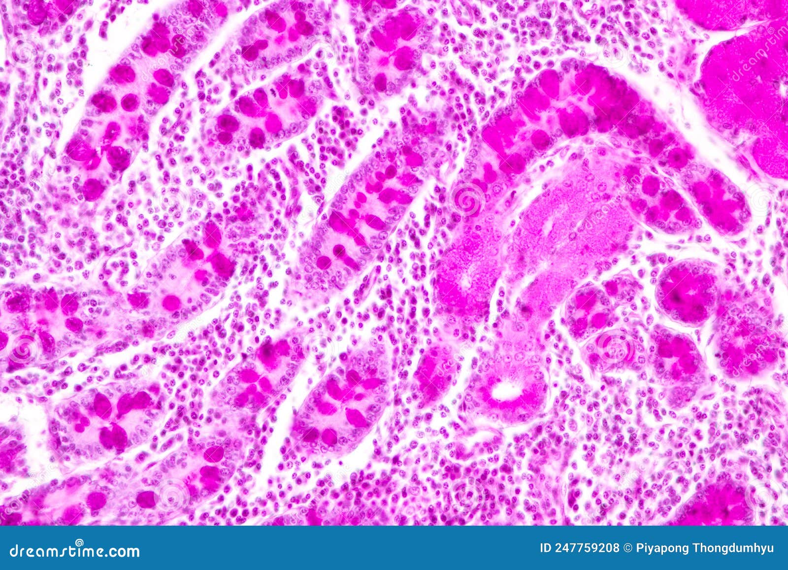 Small Intestine Duodenum and Vermiform Appendix Human Under the ...