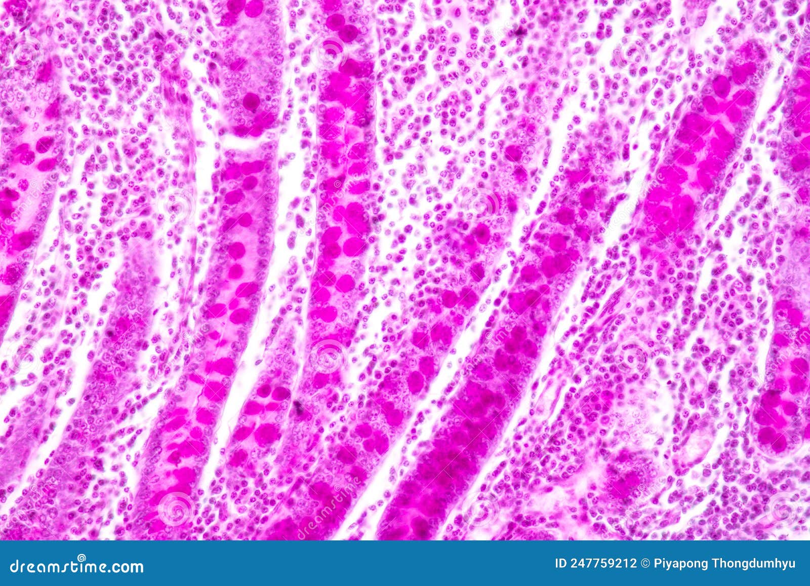 Small Intestine Duodenum and Vermiform Appendix Human Under the ...