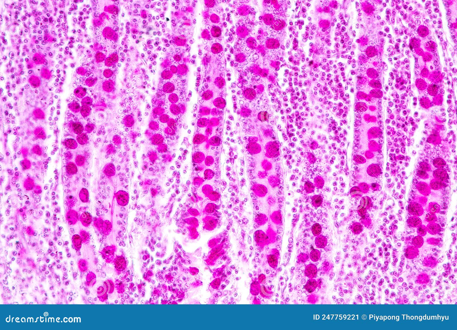 Small Intestine Duodenum and Vermiform Appendix Human Under the ...
