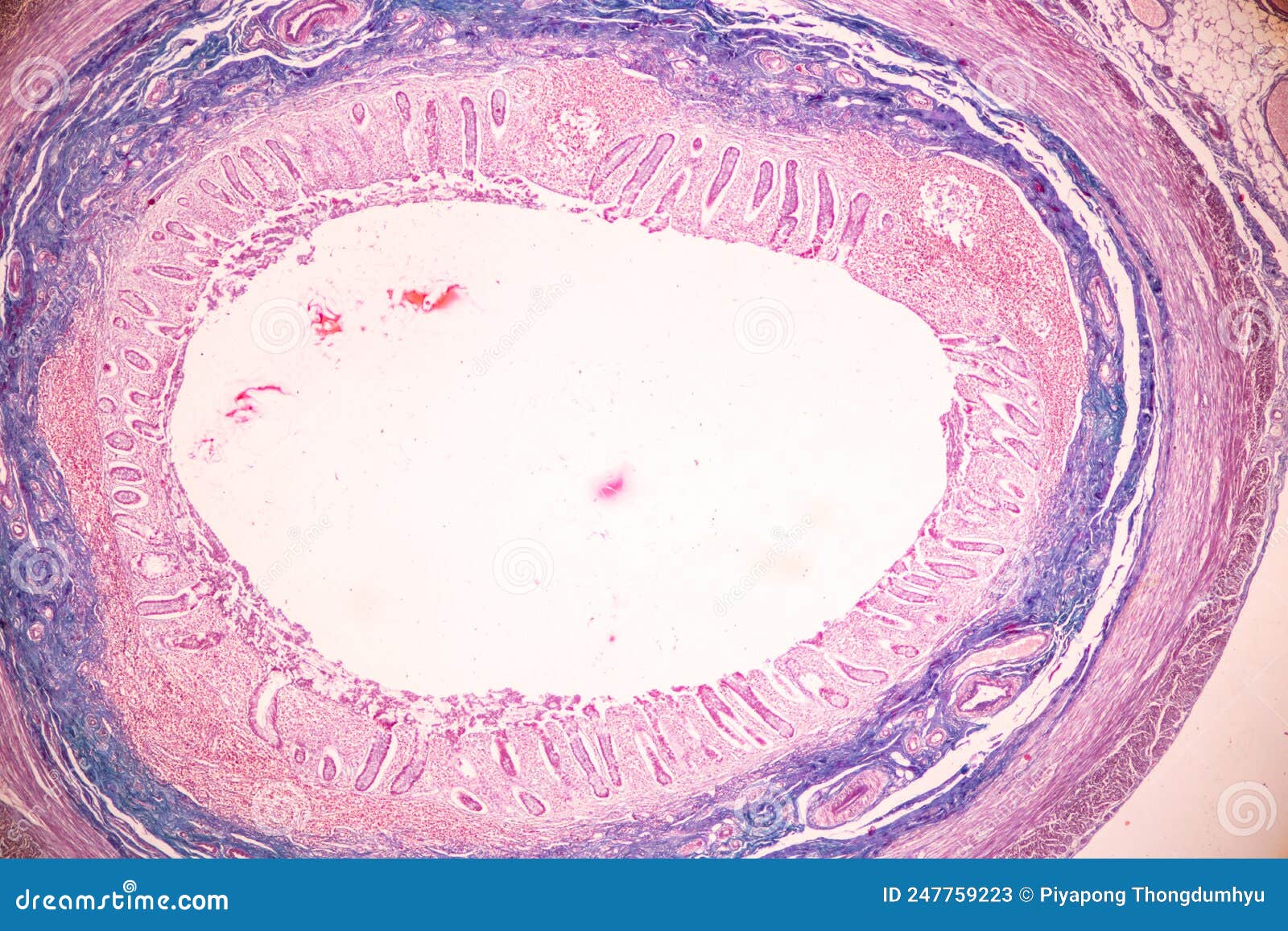 Human Duodenum Histology